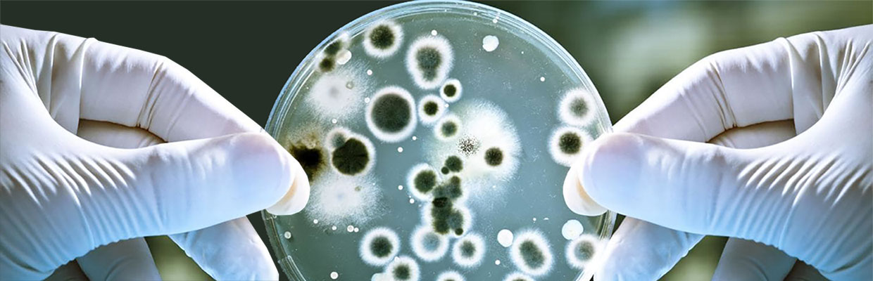 Mould Busters UK – Mould removal specialists